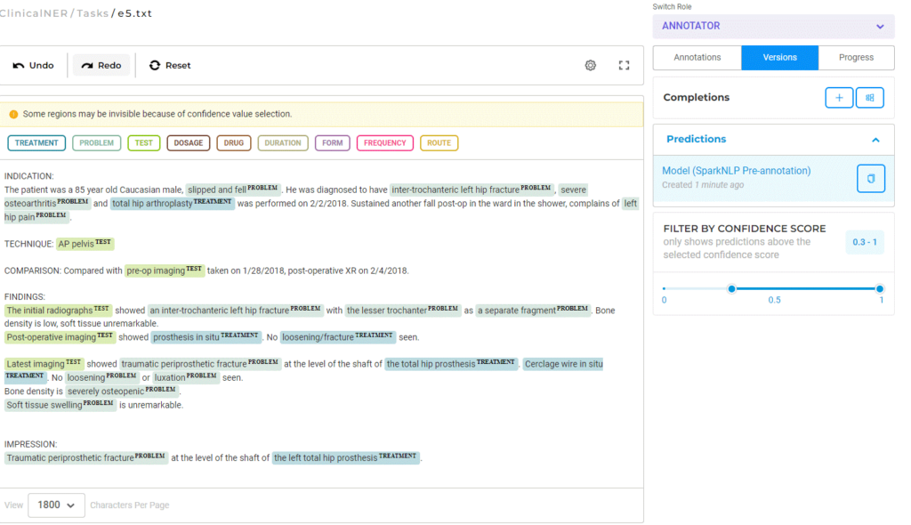 Opportunities of No-Code AI platforms | No code NLP Solutions