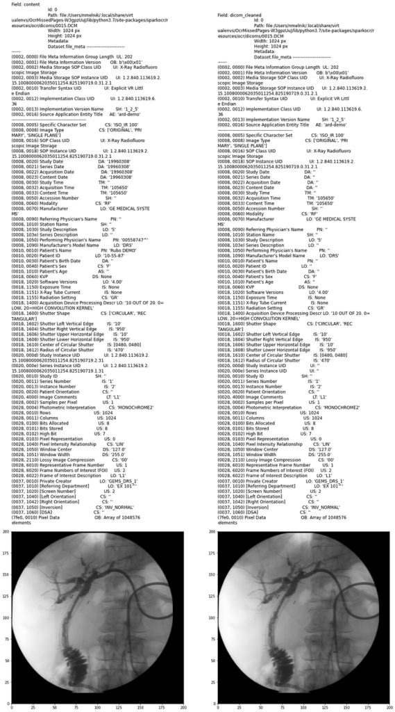 DICOM de-identification at scale in Visual NLP 2/3 - John Snow Labs